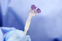 Film: Ambulerende sykepleieteam: Opplæringsfilmer - Kompetansebroen